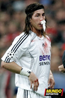 SARI"Q": Sergio Ramos jugará en el Camp Nou pese a la fisura en su nariz